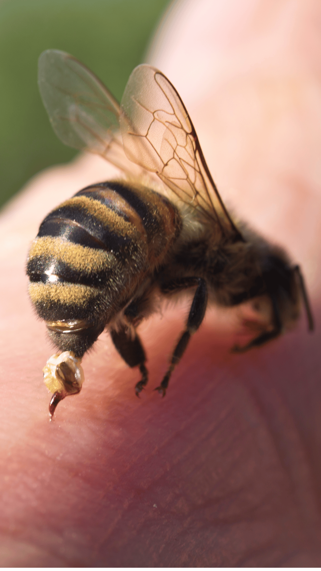 Calendeel plus | Bijen- en wespensteken herkennen